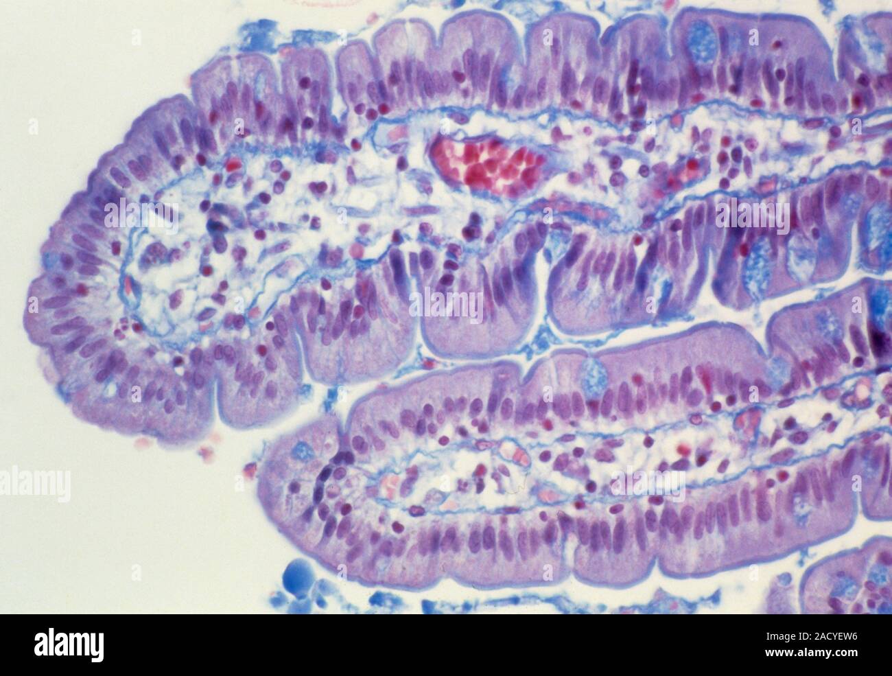 Small intestine lining. Light micrograph of a section through villi ...
