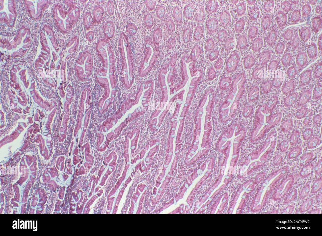 Small intestine lining. Light micrograph of a section through villi ...