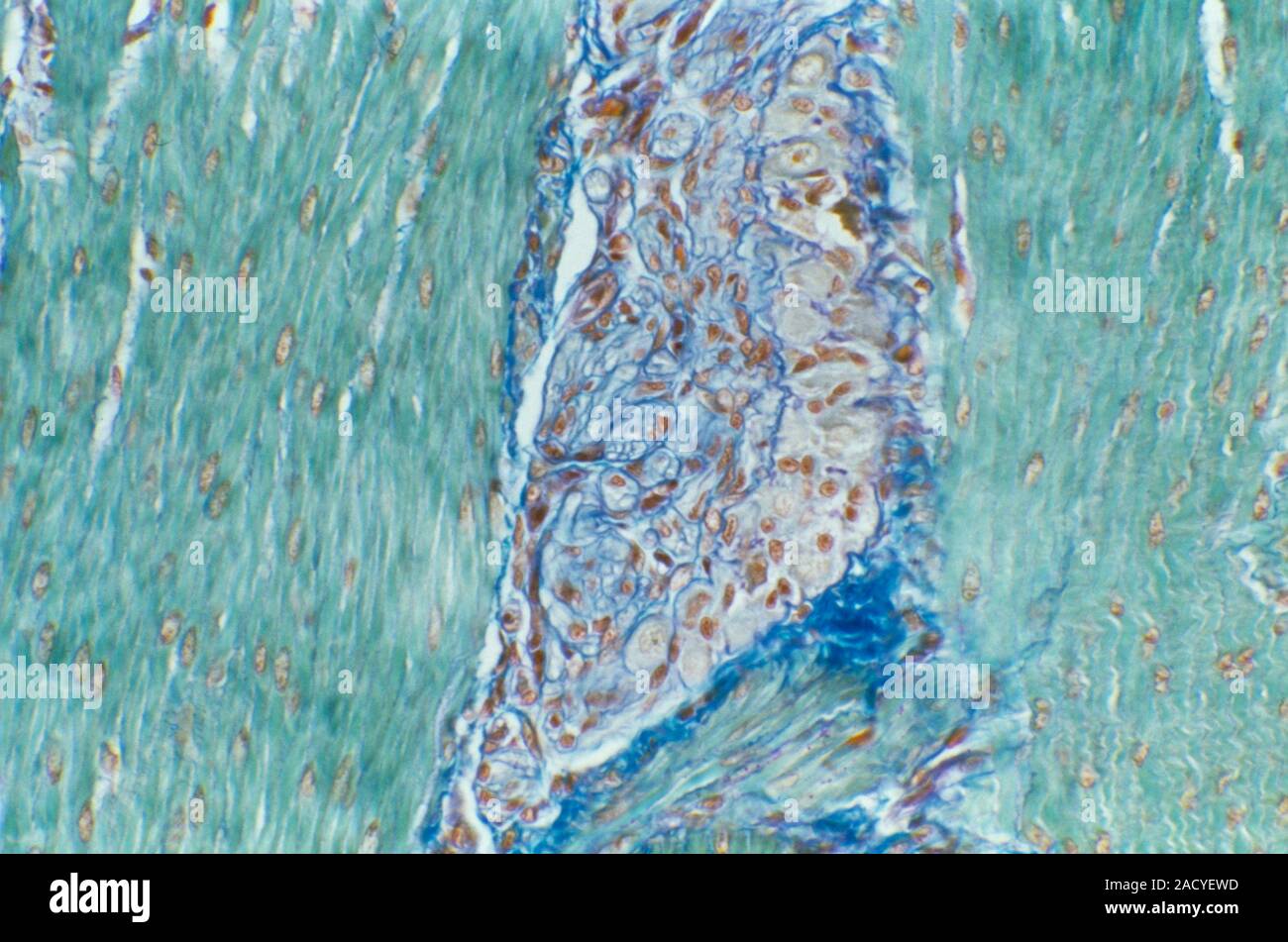 Intestinal nerves. Light micrograph of a section through the lining ...