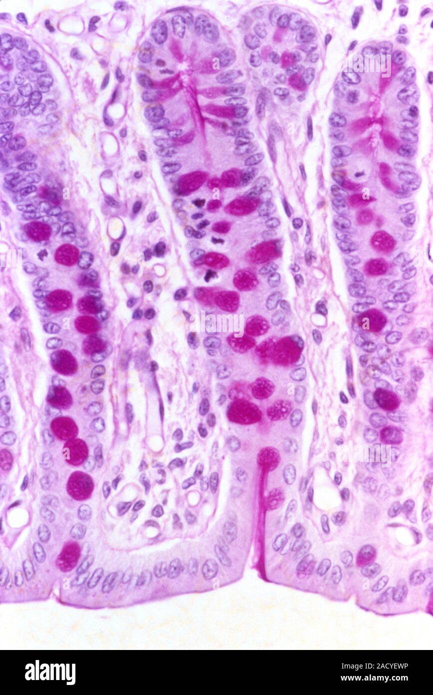 Large intestine lining. Light micrograph of a section through villi ...