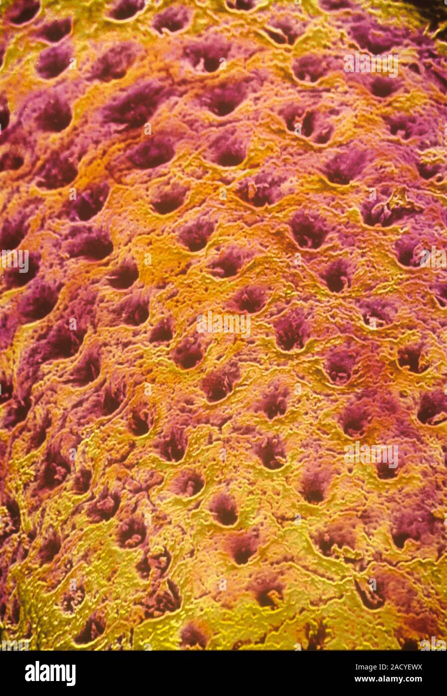 Large intestine lining. Coloured scanning electron micrograph (SEM ...