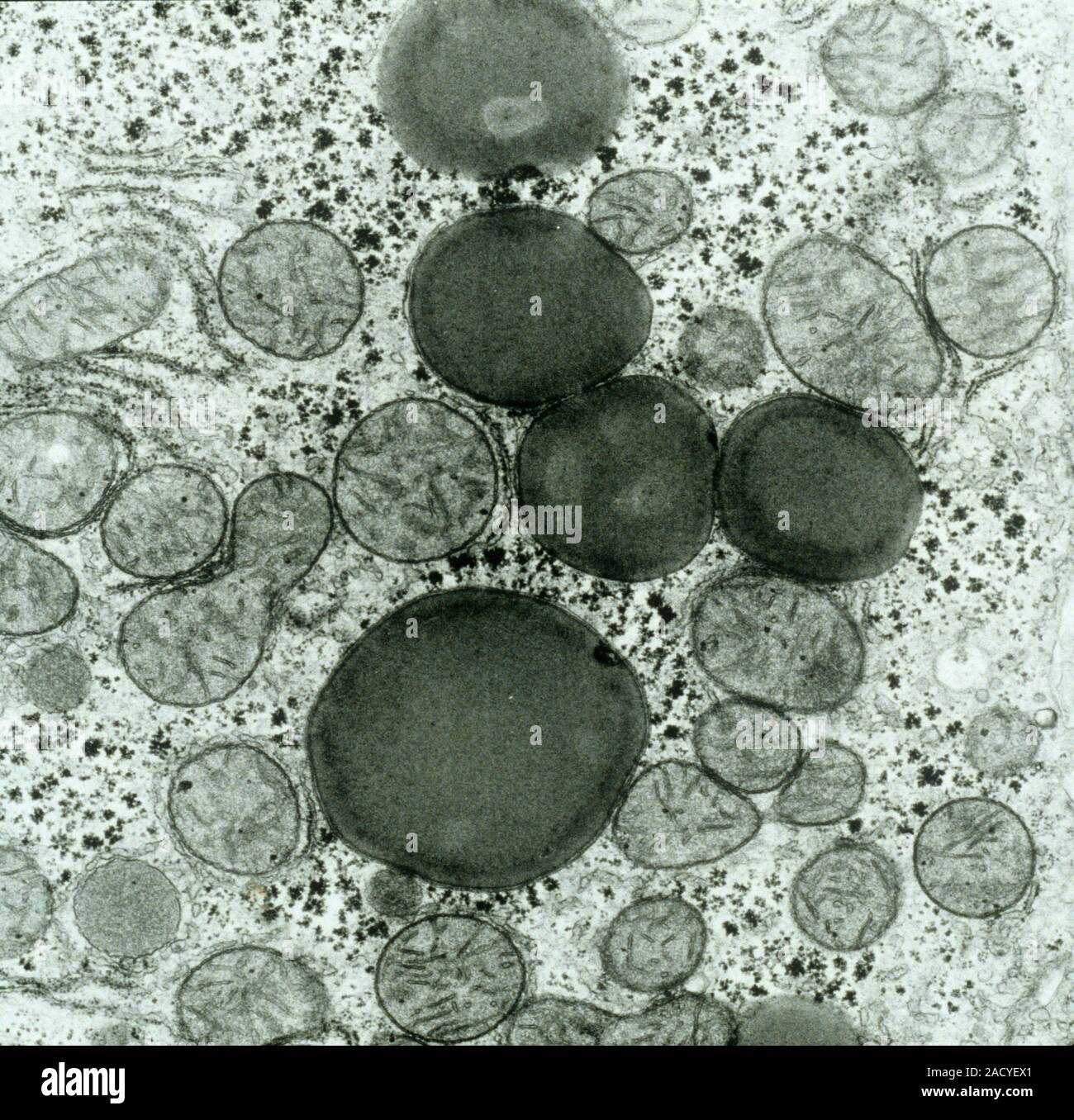 Hepatocyte liver cell. Transmission electron micrograph (TEM) of a ...
