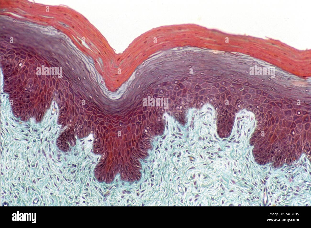 Uterus. Light micrograph of a section through the ectocervix region of ...
