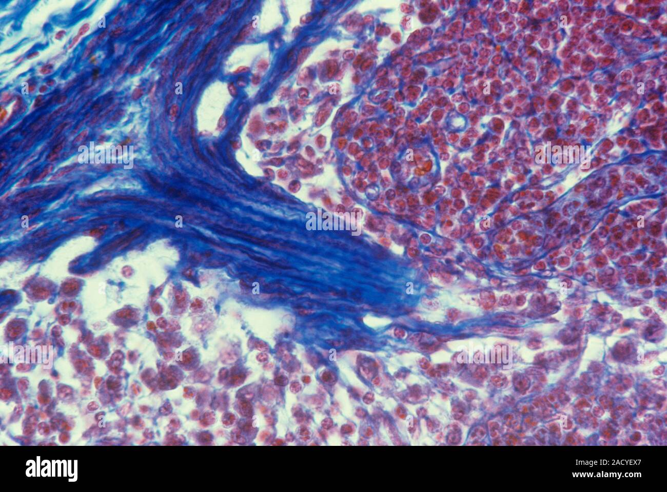 Lymph node. Light micrograph of a section through a lymph node. Lymph ...