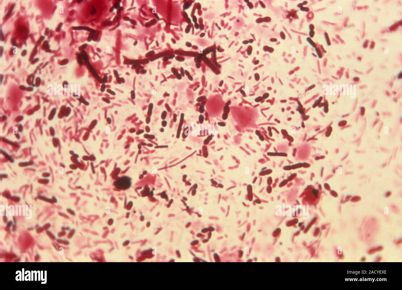 Intestinal bacteria. Gram-stained light micrograph of bacteria sampled ...