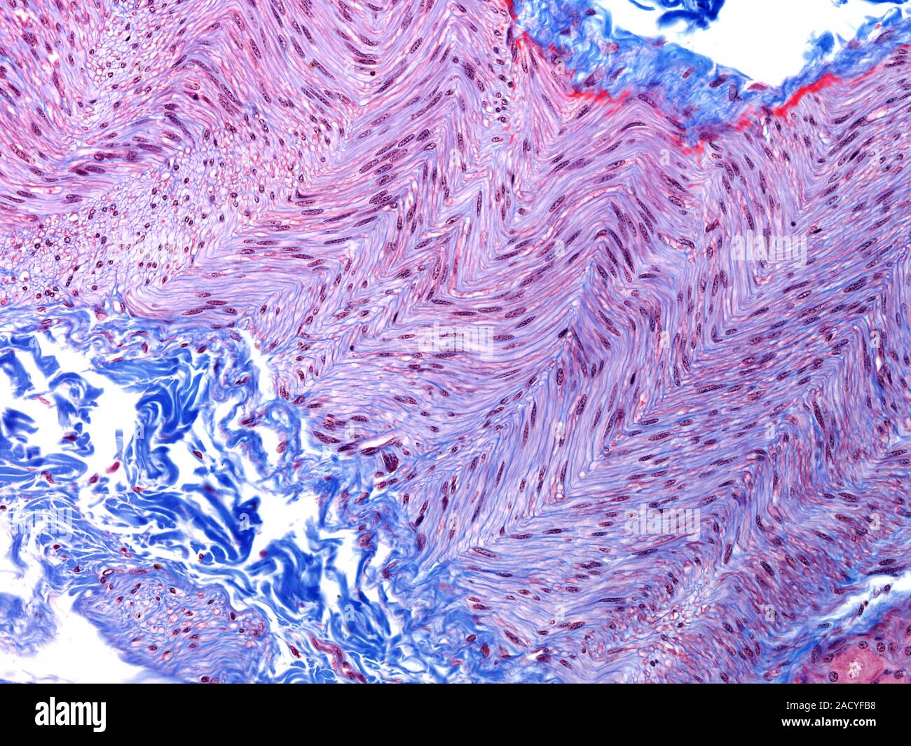 Peripheral nerve. Light micrograph of a section through non-myelinated ...