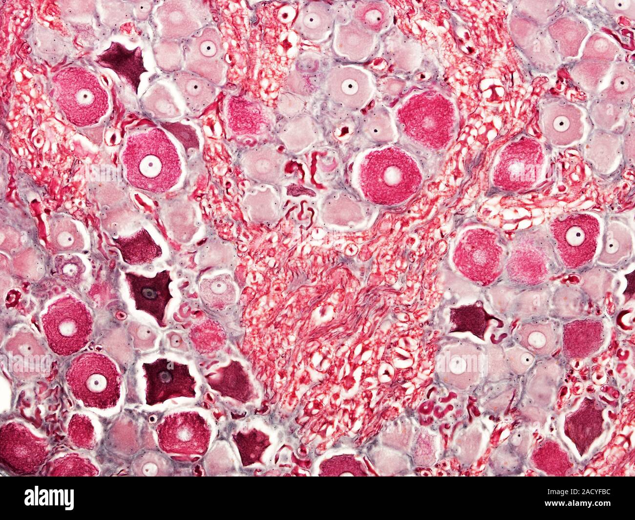 Nerve ganglion. Light micrograph of section through a group of neuron ...