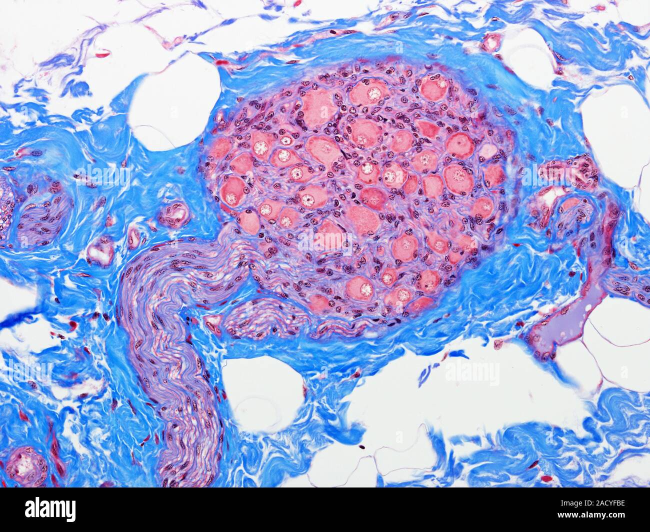 Nerve ganglion. Light micrograph of a section through a cluster of ...