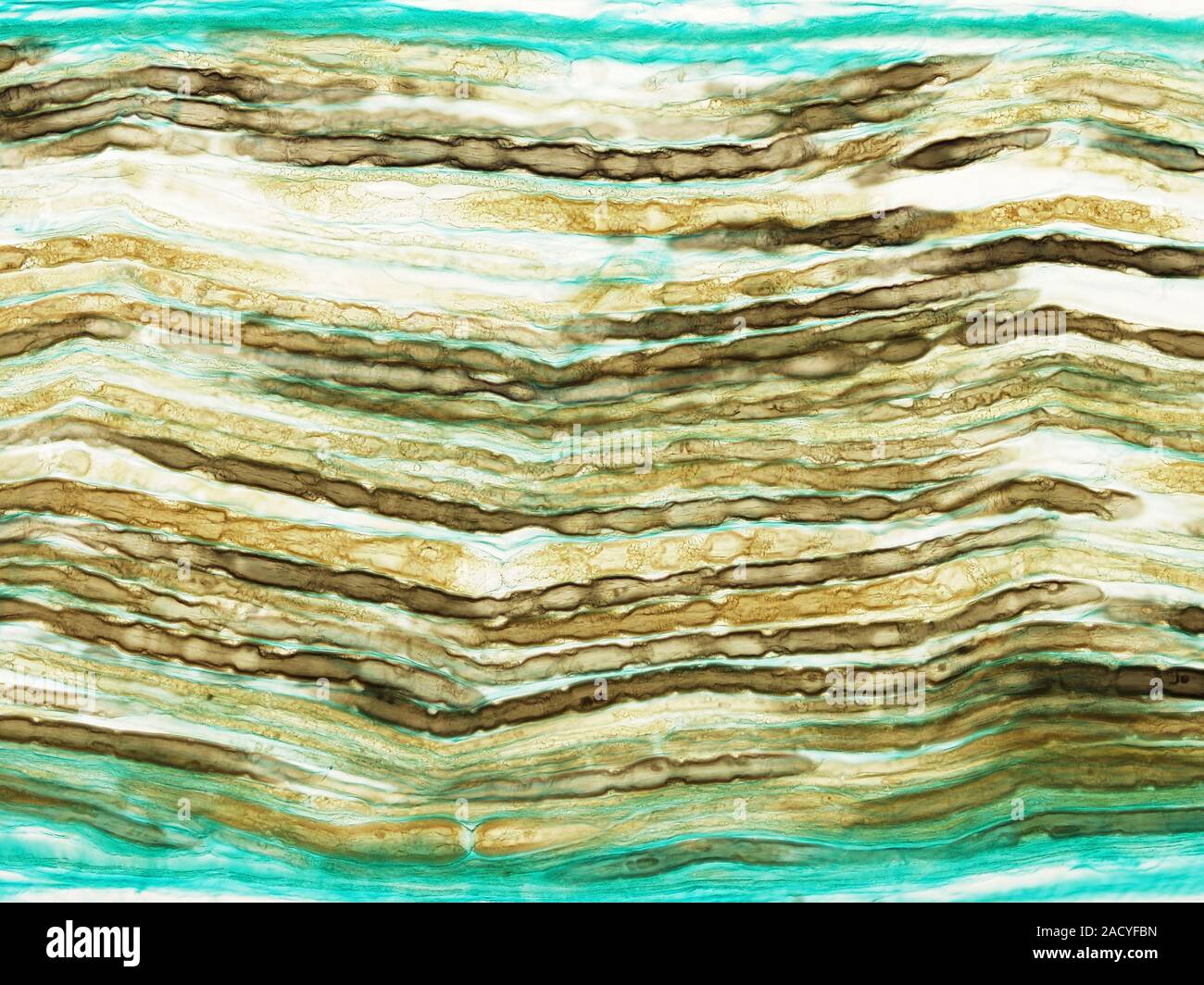 Peripheral nerve. Light micrograph of a peripheral nerve and its ...