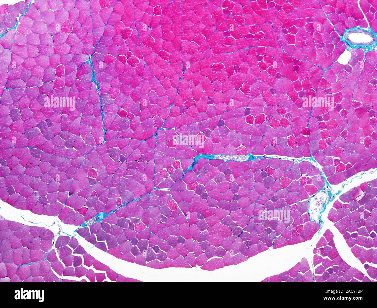 Skeletal muscle tissue. Light micrograph of a cross-section through ...