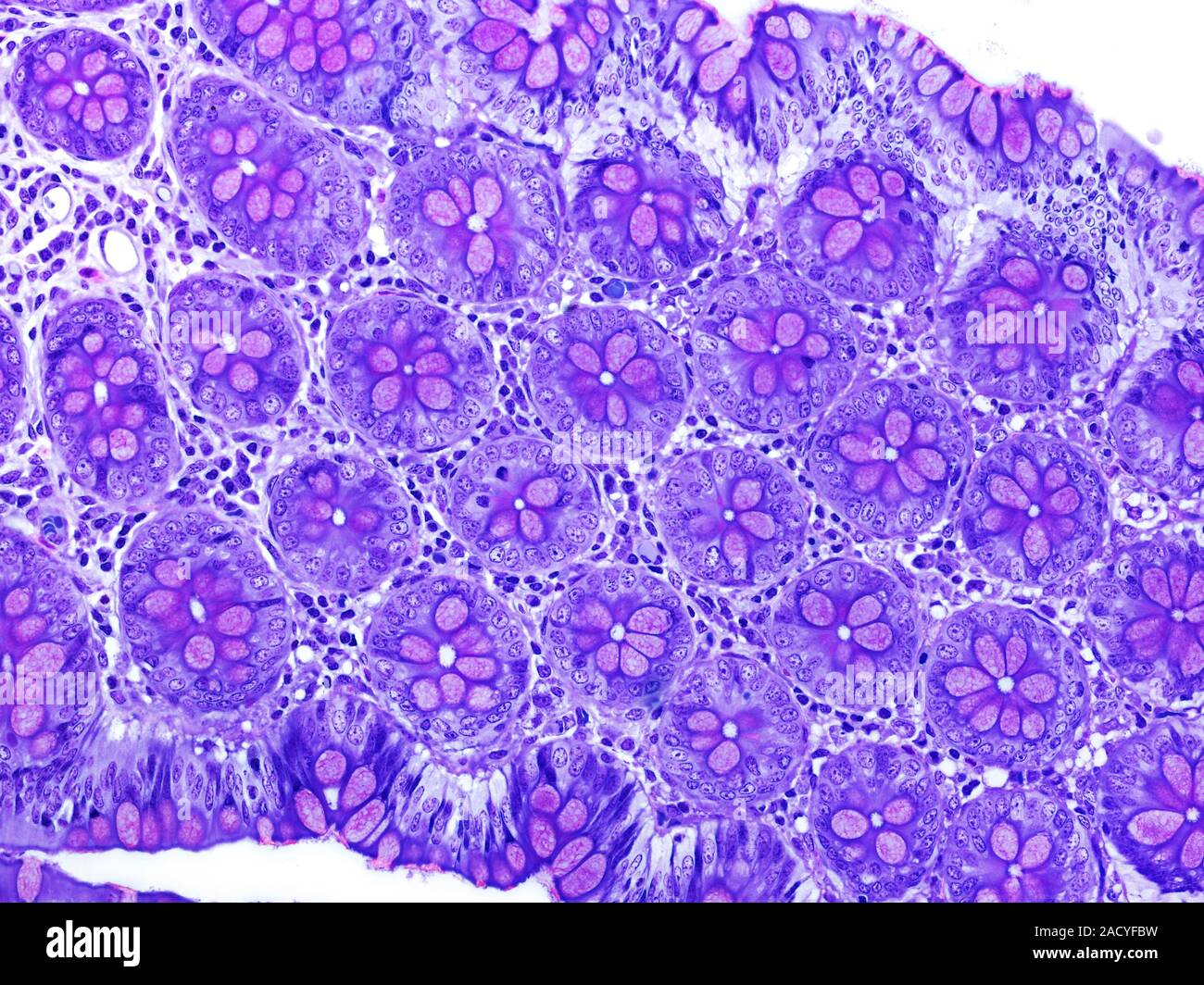 Small intestine tissue. Light micrograph of a longitudinal section ...
