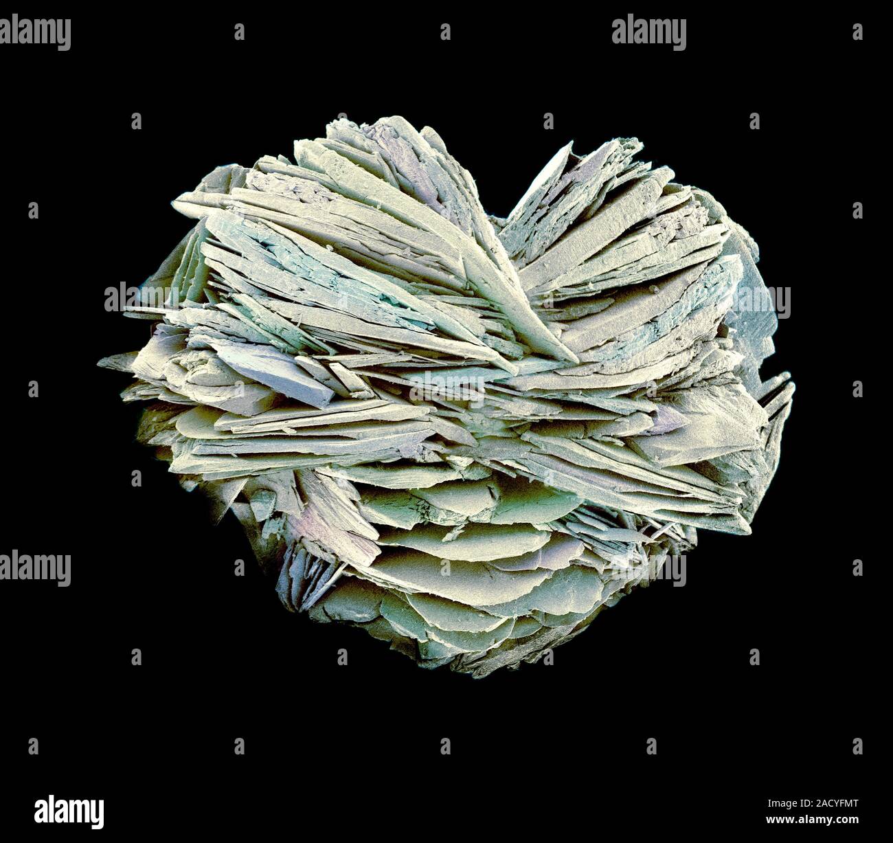 Kidney stone, coloured scanning electron micrograph (SEM). Kidney ...