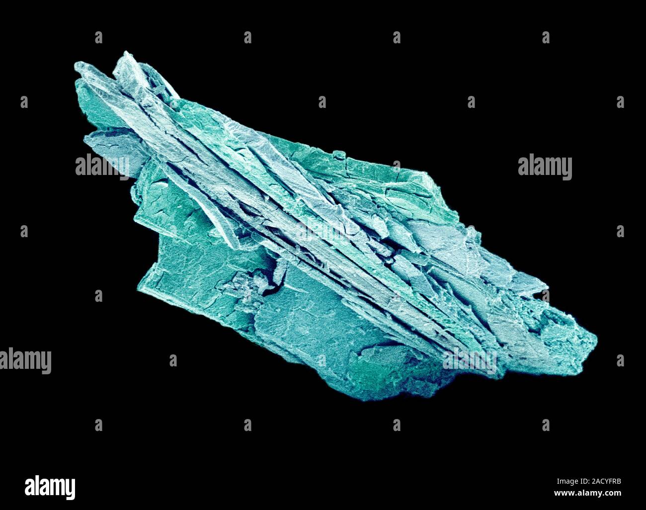 Kidney stone. Coloured scanning electron micrograph (SEM) of the ...