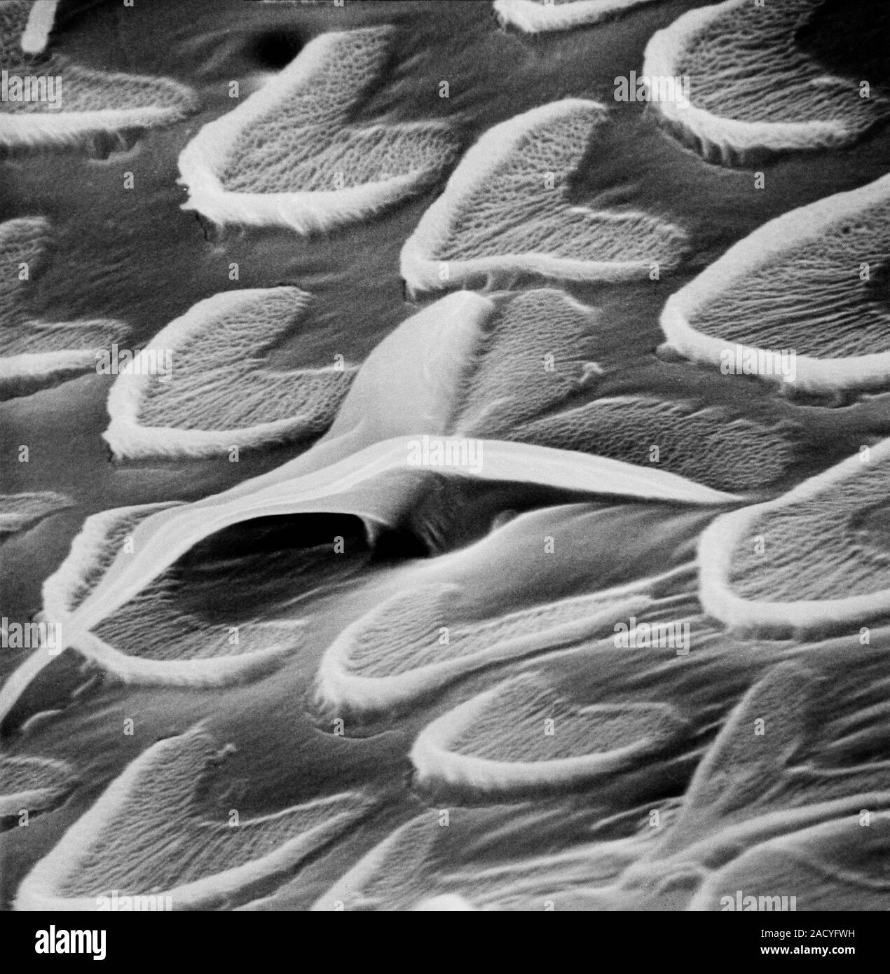 Scanning electron microscope image of the underside of some snail teeth ...