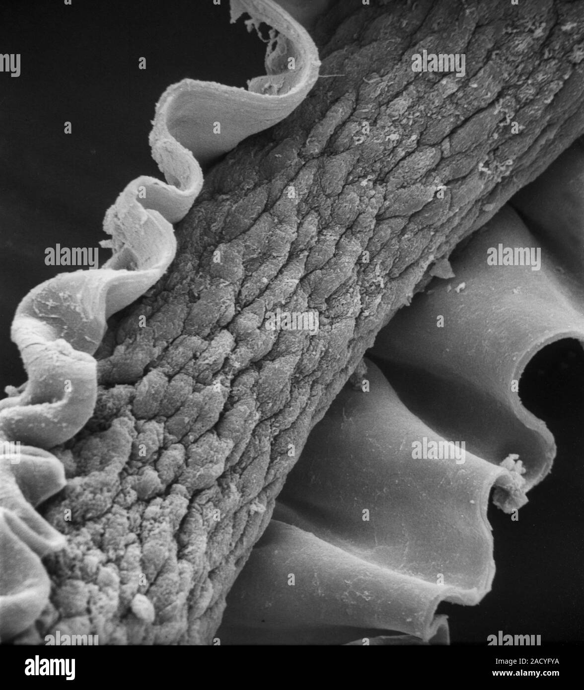 Scanning electron microscope (SEM) image showing a human hair with the ...