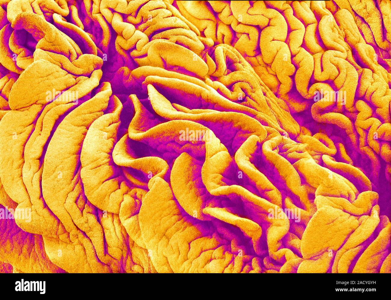Fimbriae of a fallopian tube, coloured scanning electron micrograph ...