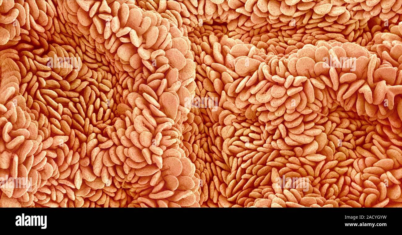 Intestinal lining. Coloured scanning electron micrograph (SEM) of villi ...