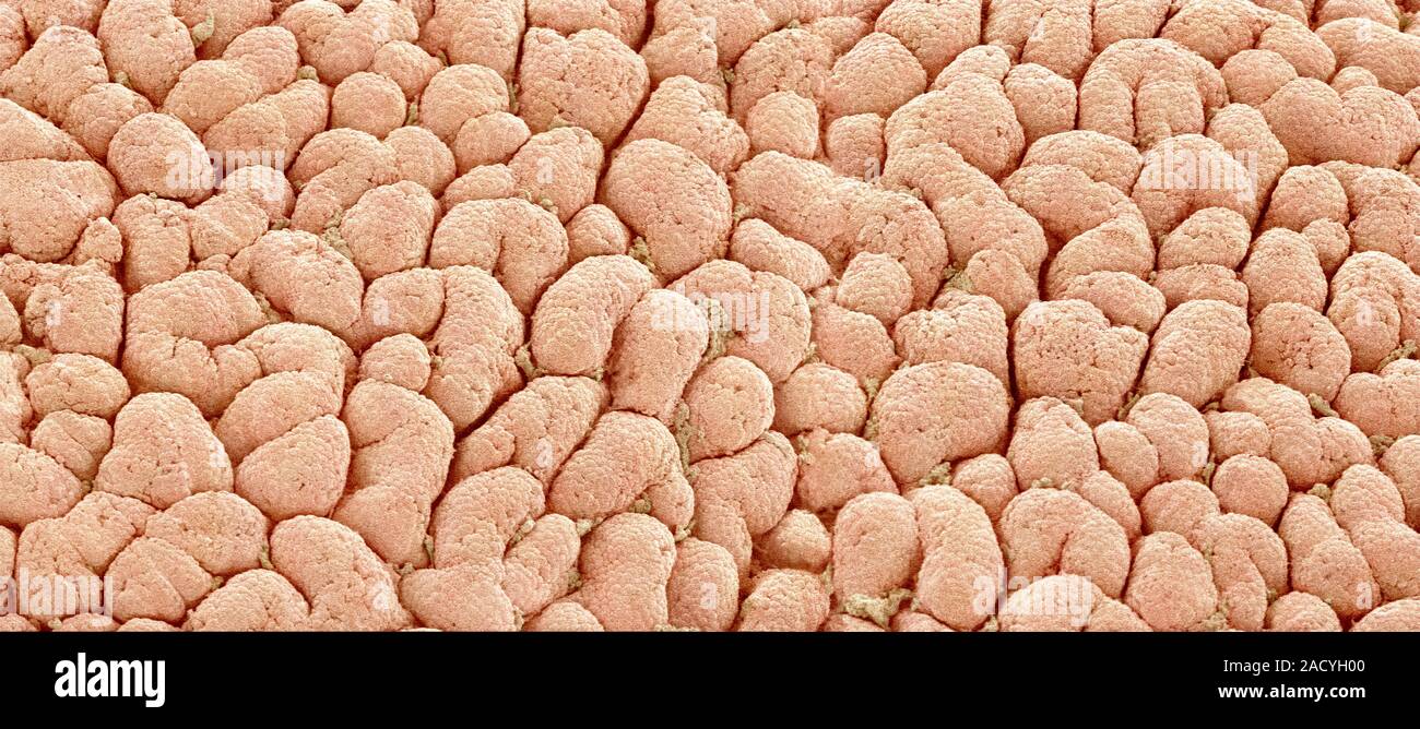 Intestinal lining. Coloured scanning electron micrograph (SEM) of villi ...