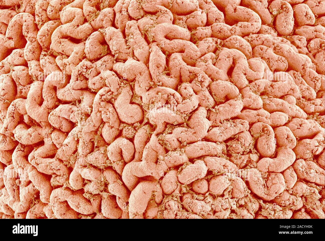 Intestinal lining. Coloured scanning electron micrograph (SEM) of villi ...