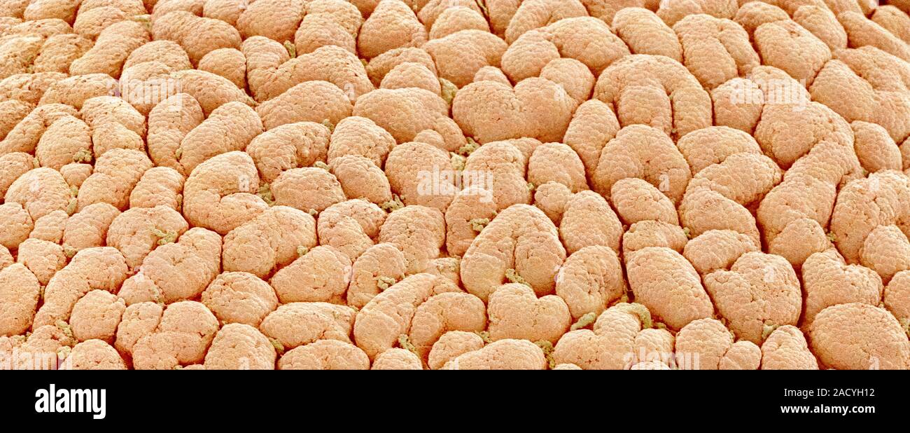 Intestinal lining. Coloured scanning electron micrograph (SEM) of villi ...