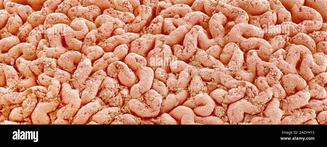 Intestinal lining. Coloured scanning electron micrograph (SEM) of villi ...