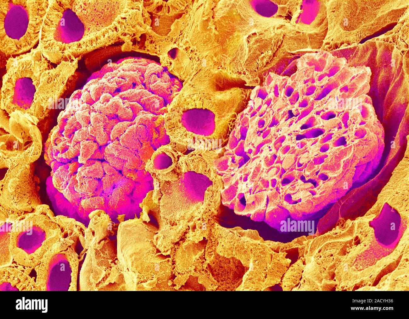 Kidney glomeruli. Coloured scanning electron micrograph (SEM) of two ...