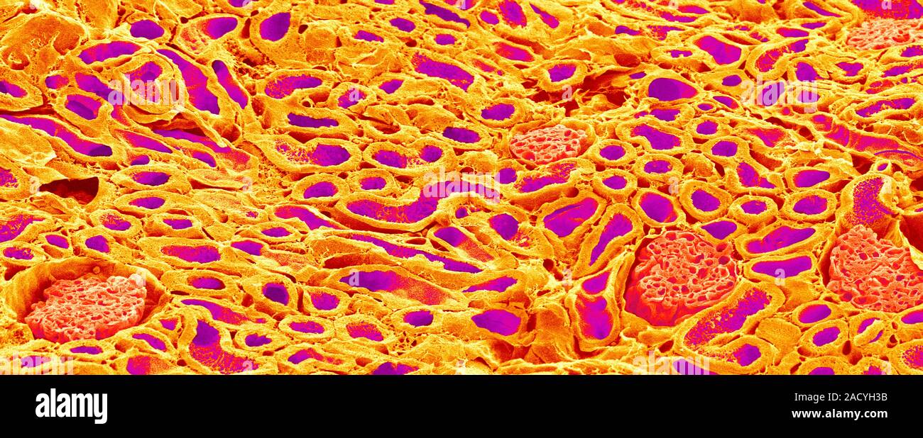 Kidney glomeruli. Coloured scanning electron micrograph (SEM) of glomeruli (red) surrounded by ...