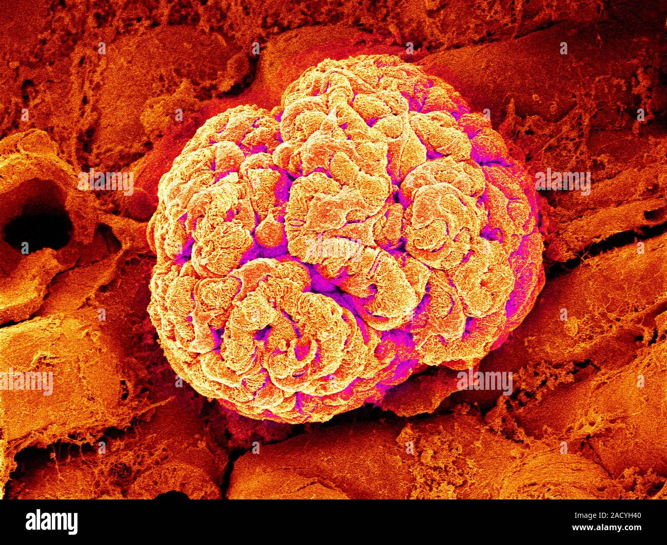 Kidney glomerulus. Coloured scanning electron micrograph (SEM) of ... Kidney glomerulus. Coloured scanning electron micrograph (SEM) of ...
