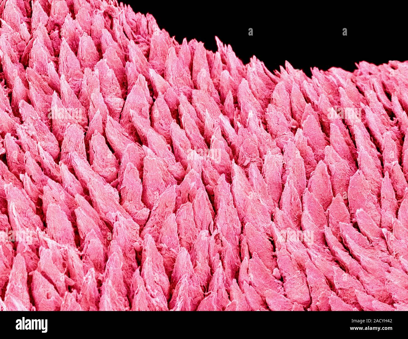 Tongue surface, coloured scanning electron micrograph (SEM). The tongue ...
