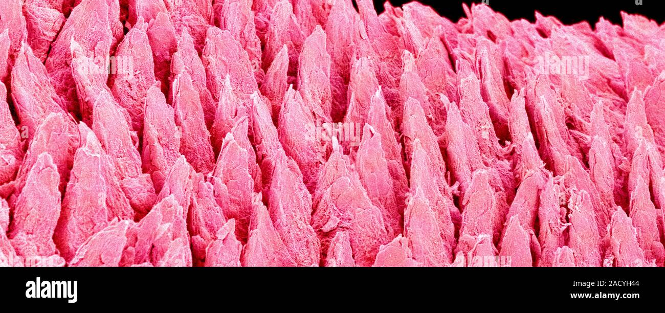 Tongue surface, coloured scanning electron micrograph (SEM). The tongue ...