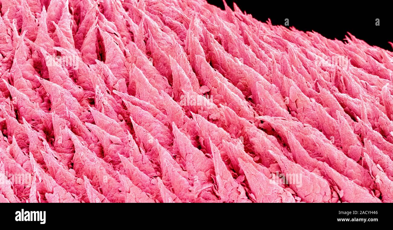 Tongue surface, coloured scanning electron micrograph (SEM). The tongue ...
