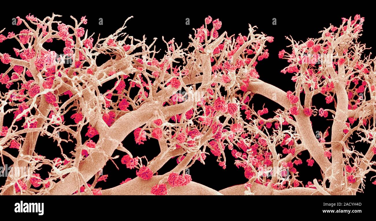 Kidney blood vessels. Coloured scanning electron micrograph (SEM) of a ...