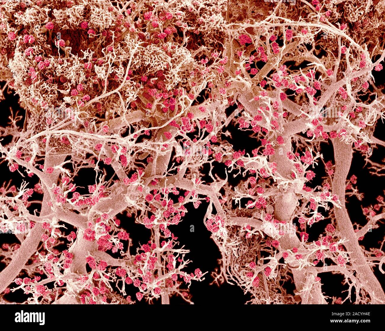 Kidney blood vessels. Coloured scanning electron micrograph (SEM) of a ...