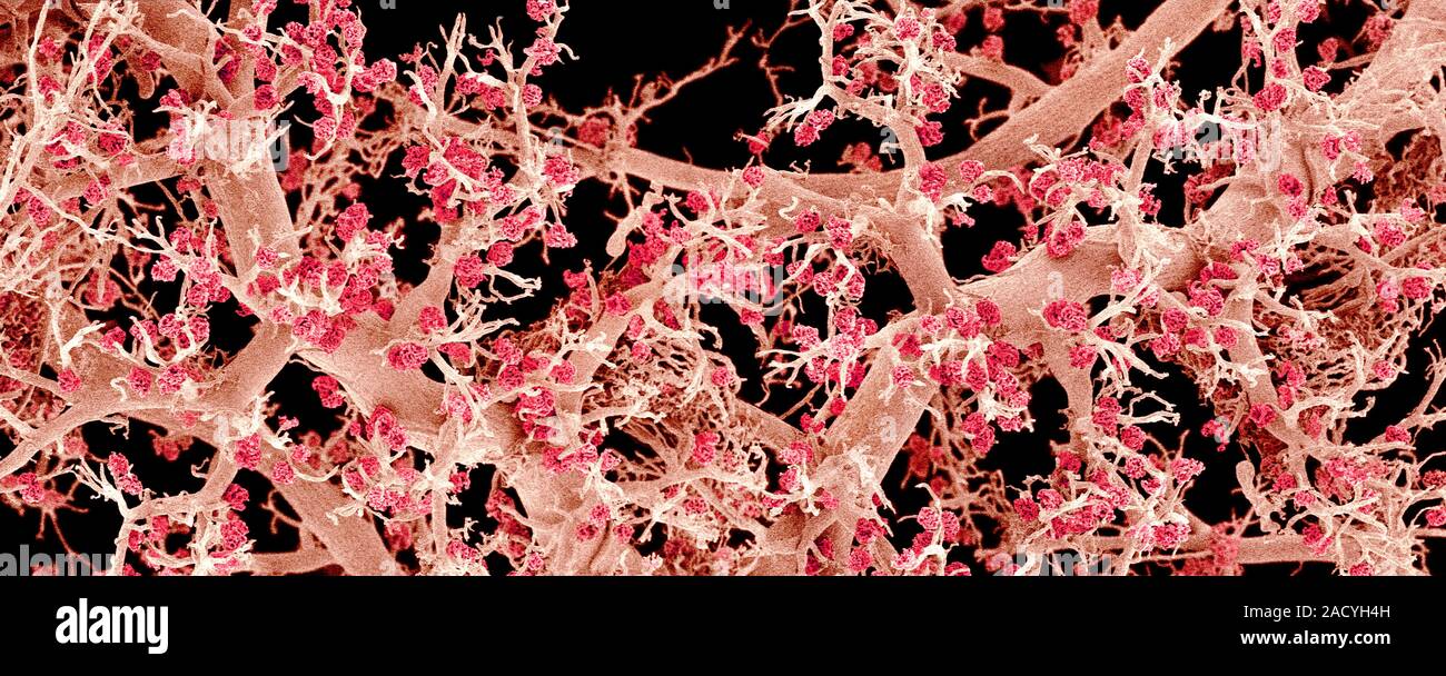 Kidney blood vessels. Coloured scanning electron micrograph (SEM) of a ...