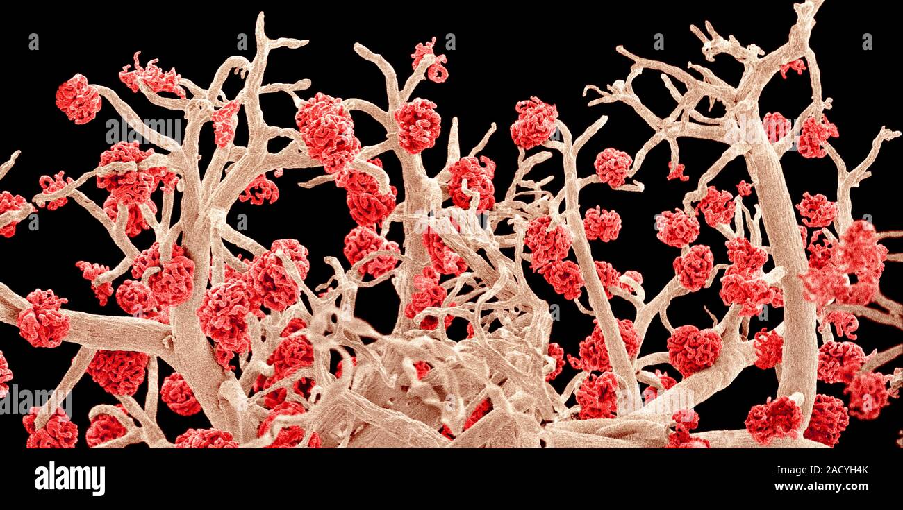 Kidney blood vessels. Coloured scanning electron micrograph (SEM) of a ...