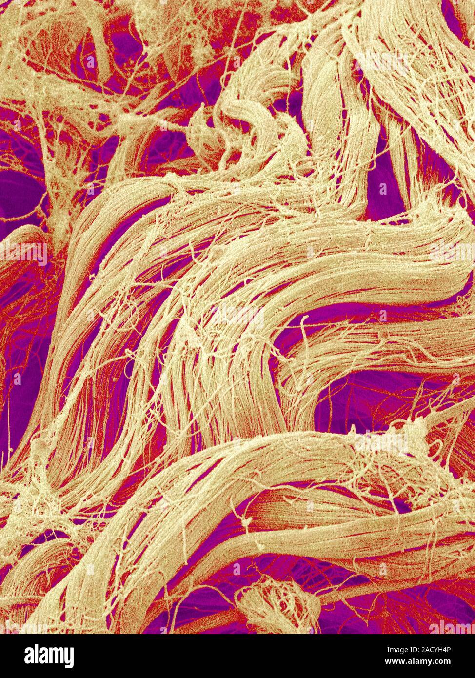 Collagen fibres. Coloured scanning electron micrograph (SEM) of ...