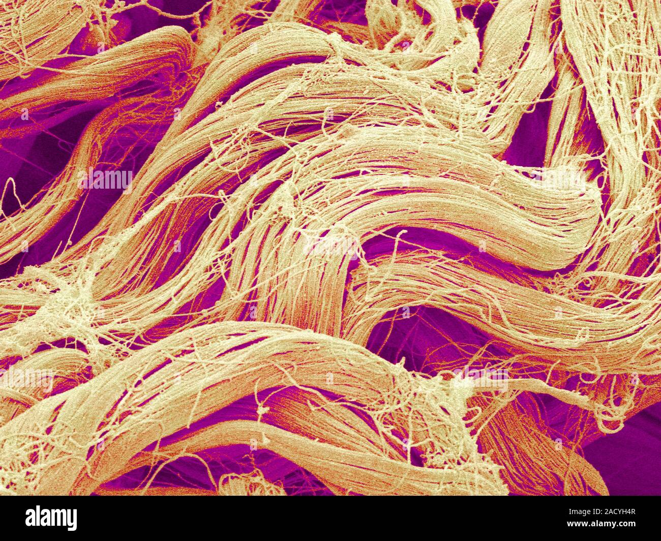 Collagen fibres. Coloured scanning electron micrograph (SEM) of ...
