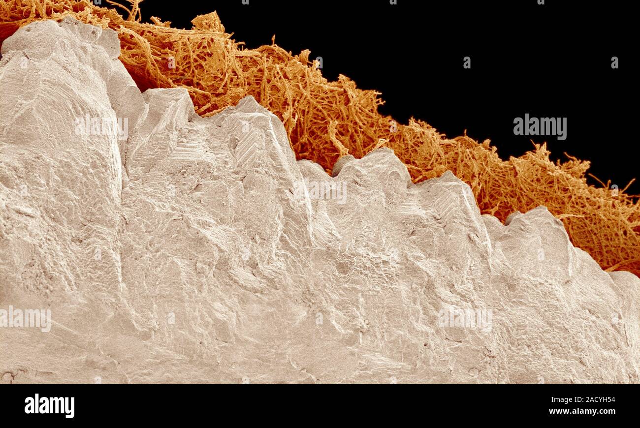 Bird egg shell, coloured scanning electron micrograph (SEM). The egg ...