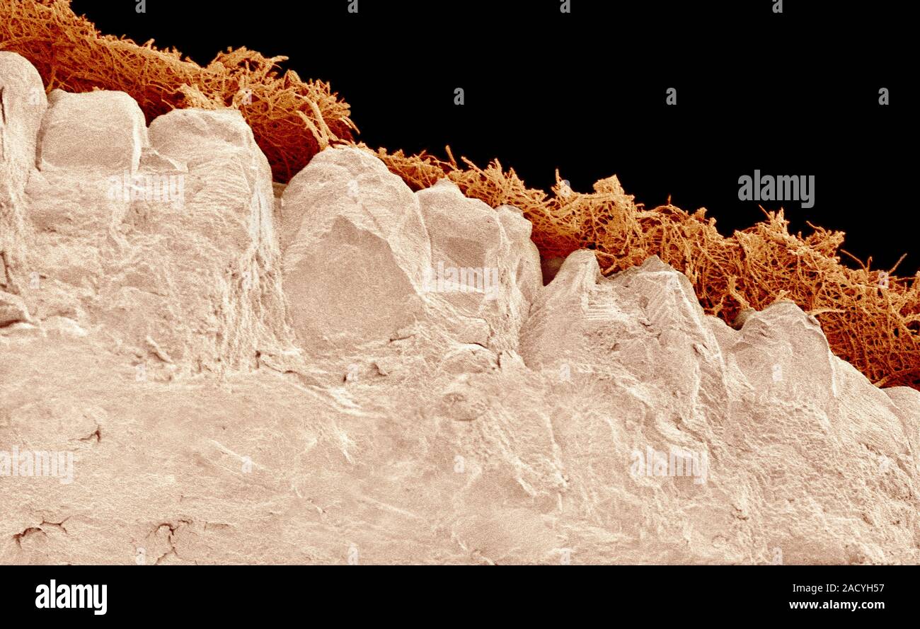 Bird egg shell, coloured scanning electron micrograph (SEM). The egg ...