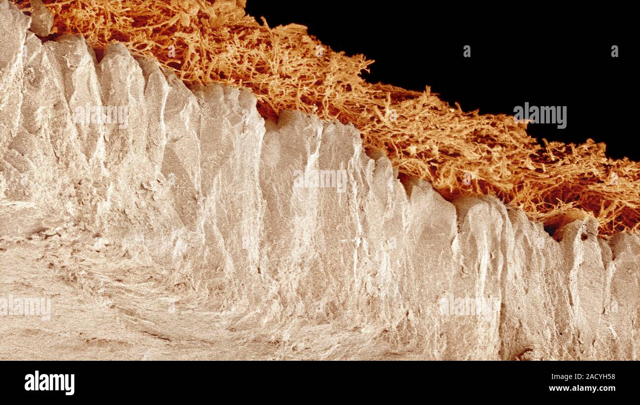 Bird egg shell, coloured scanning electron micrograph (SEM). The egg ...