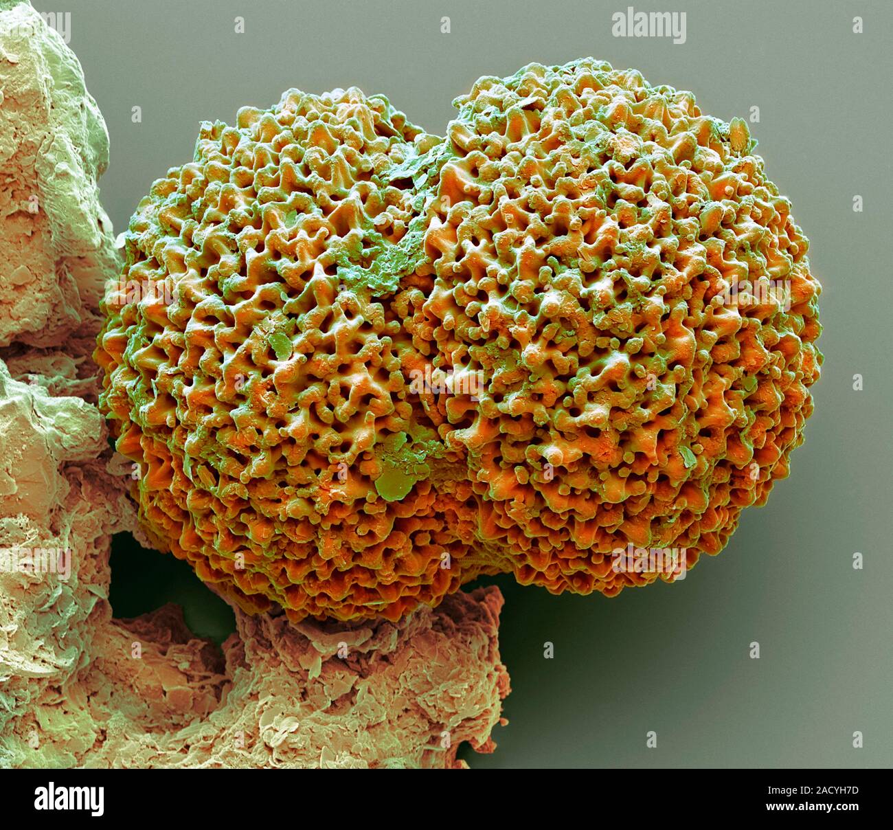 Foraminiferan, coloured scanning electron micrograph (SEM ...