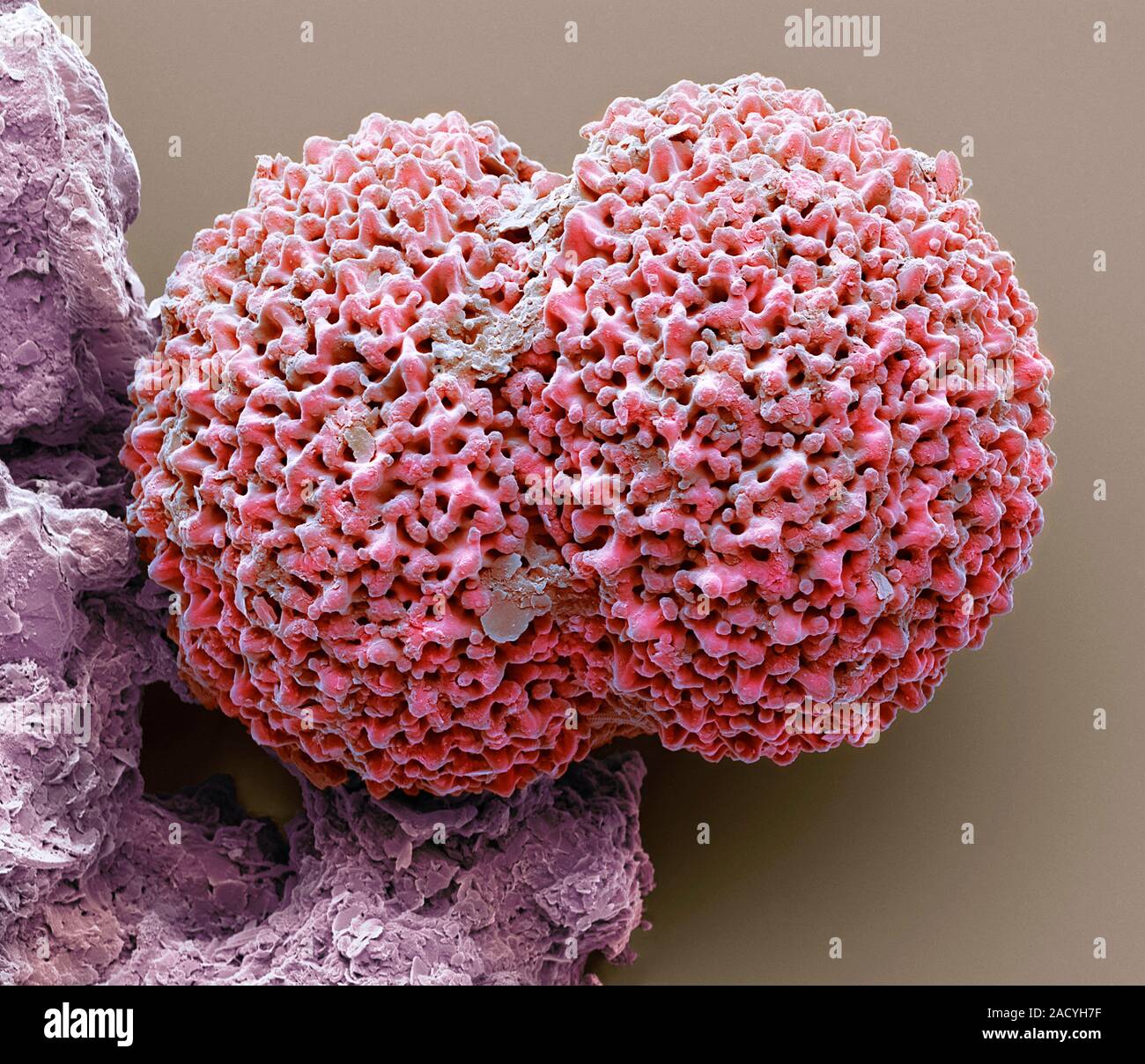 Foraminiferan, coloured scanning electron micrograph (SEM ...