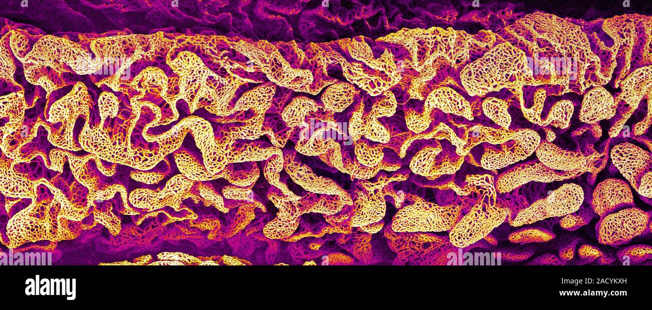 Intestinal blood vessels. Coloured scanning electron micrograph (SEM ...