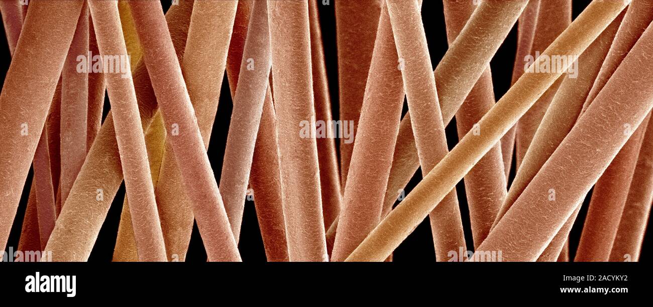 Human hairs, coloured scanning electron micrograph (SEM). Hairs are ...