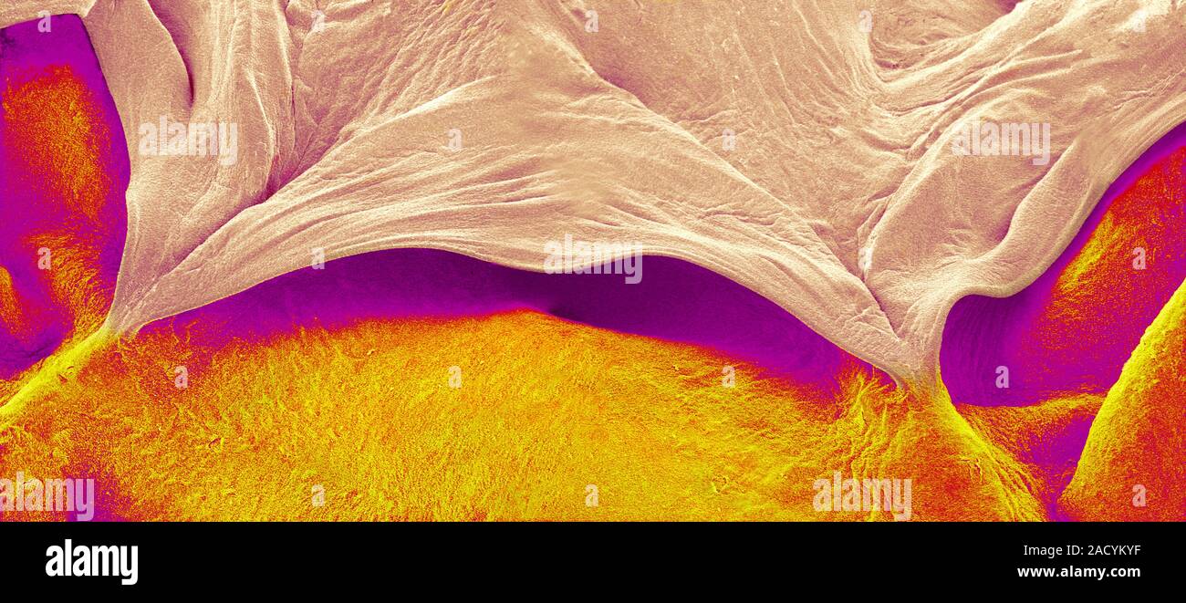 Pulmonary valve (top), coloured scanning electron micrograph (SEM). The ...