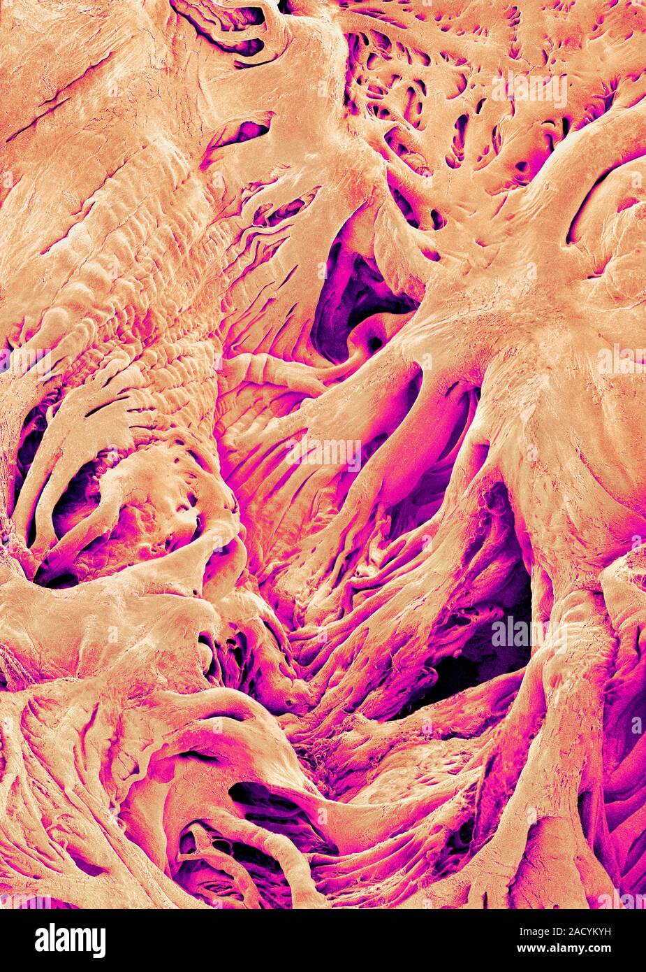 Heart muscle. Coloured scanning electron micrograph (SEM) of pectinate ...