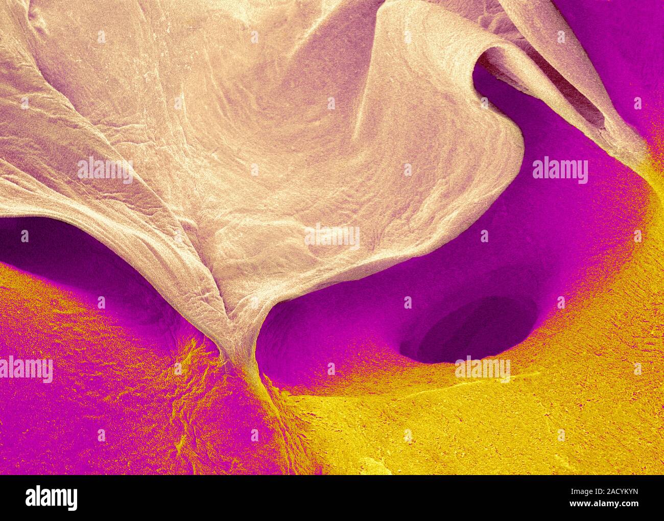 Aortic valve (top), coloured scanning electron micrograph (SEM). The ...