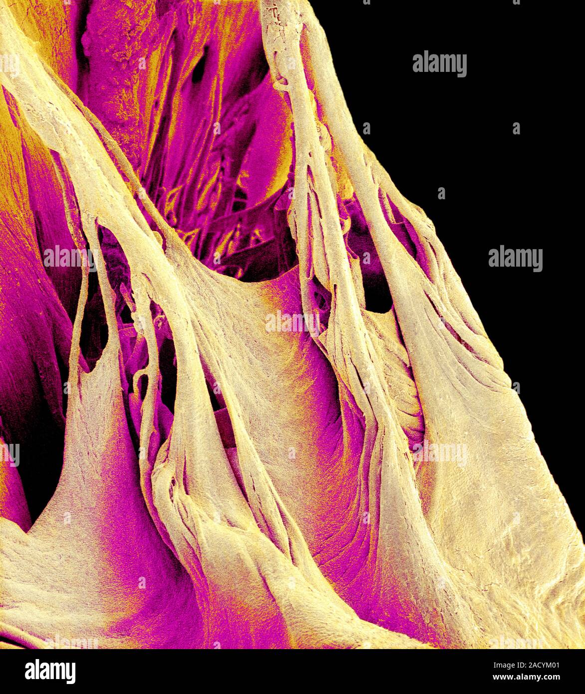 Heart valve and strings, coloured scanning electron micrograph (SEM ...