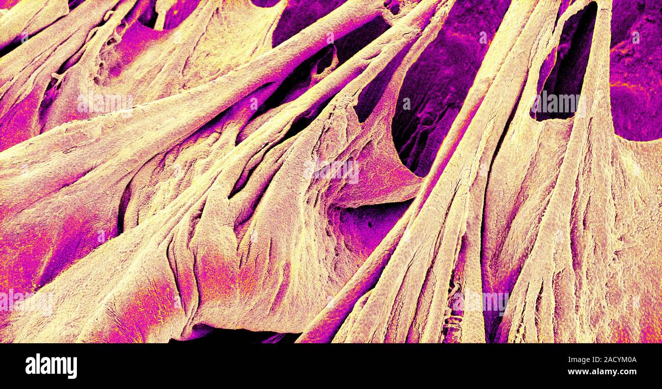 Heart valve and strings, coloured scanning electron micrograph (SEM ...