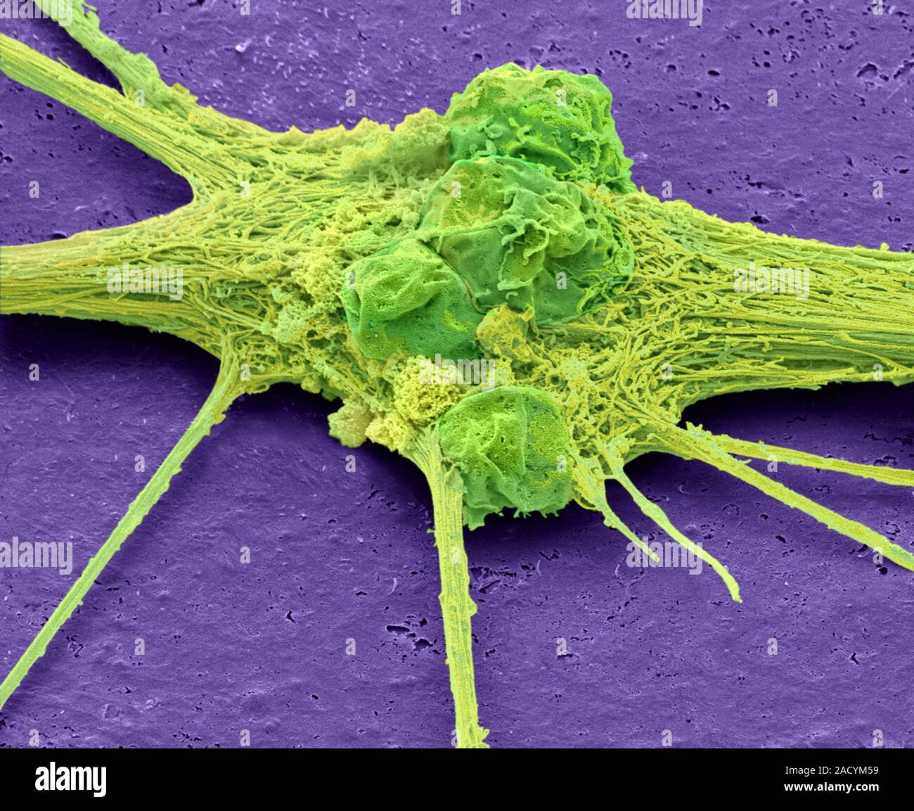 Stem cell-derived neuron. Coloured scanning electron micrograph (SEM ...
